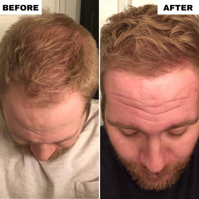 Scalphero™ Smart Scalp Massager Scalp Hero Store